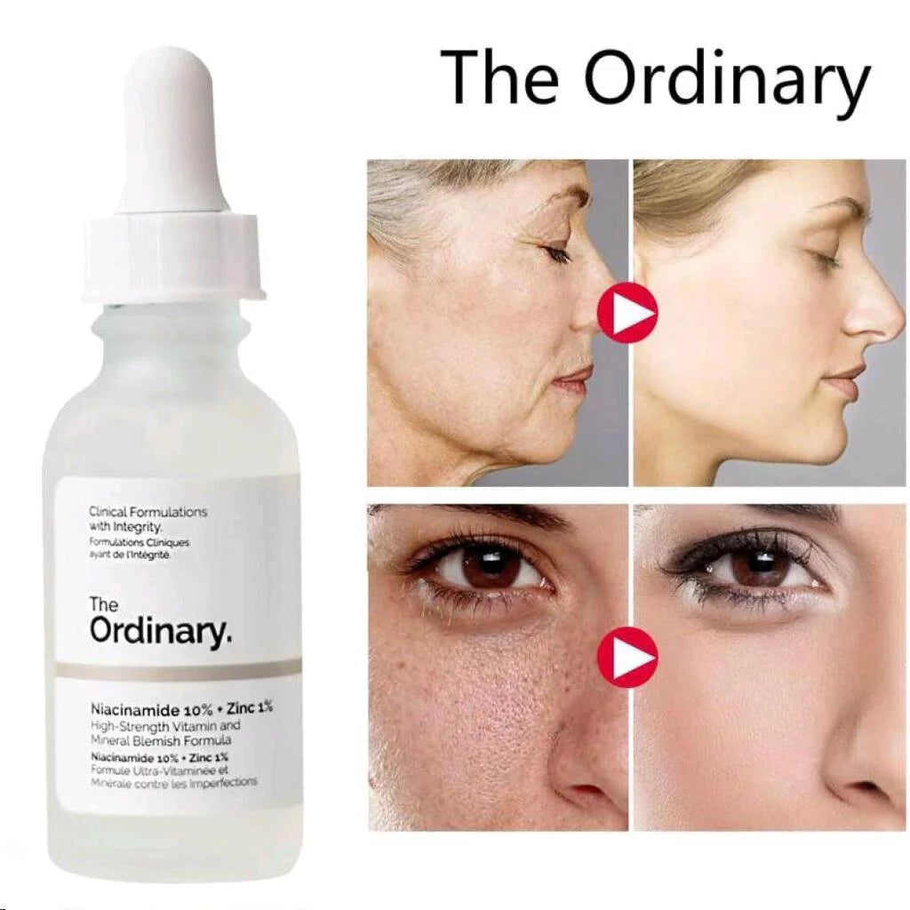 The Ordinary- Niacinamide 10% + Zinc 1% 30Ml – Glow Bazar
